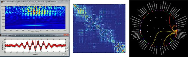 Brainstorm: A MATLAB Based, Open-Source Application for Advanced MEG ...