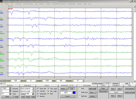 EEG Data Processing and Classification with g.BSanalyze Under MATLAB ...