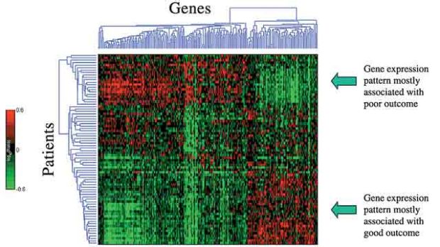 Rosetta Predicts the Clinical Outcome of Breast Cancer Patients ...