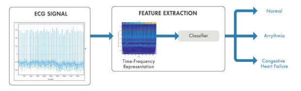 Biomedical Signal Processing Matlab And Simulink