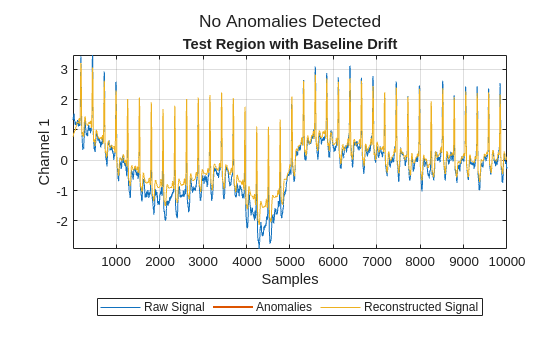 Detect Anomalies in Signals Using deepSignalAnomalyDetector - MATLAB & Simulink