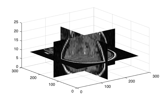 AdjustContrastOf3DVolumeExample_01.png