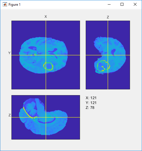 orthosliceViewer - Browse orthogonal slices in grayscale or RGB volume - MATLAB