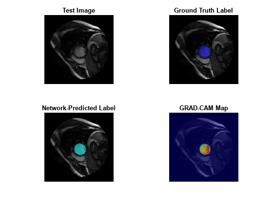 Cardiac Left Ventricle Segmentation From Cine Mri Images Using U Net Network Matlab And Simulink