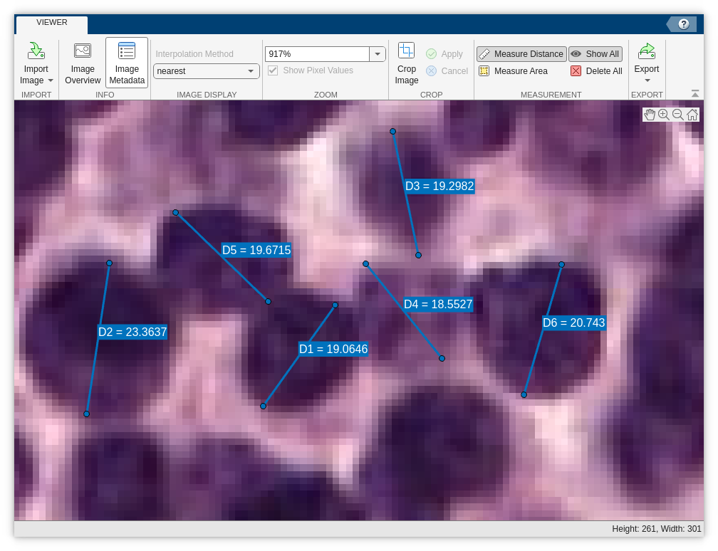 Detect Nuclei in Large Whole Slide Images Using Cellpose - MATLAB & Simulink