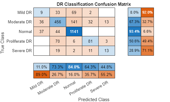 Multilabel Diabetic Retinopathy Fundus Image Classification Using Deep ...