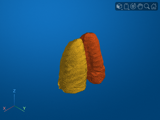 Segment Lungs from CT Scan Using Pretrained Neural Network - MATLAB & Simulink