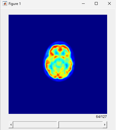 Align Brain MRI and Dynamic PET Data - MATLAB & Simulink