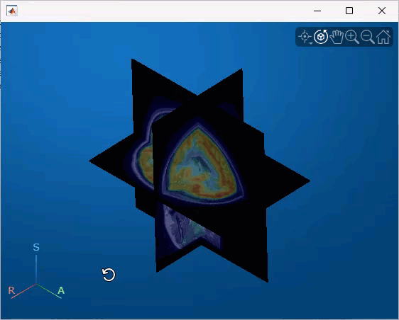 Align Brain MRI and Dynamic PET Data - MATLAB & Simulink