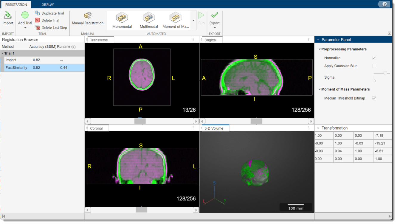 Apply Initial Transformation In Medical Registration Estimator App Matlab And Simulink