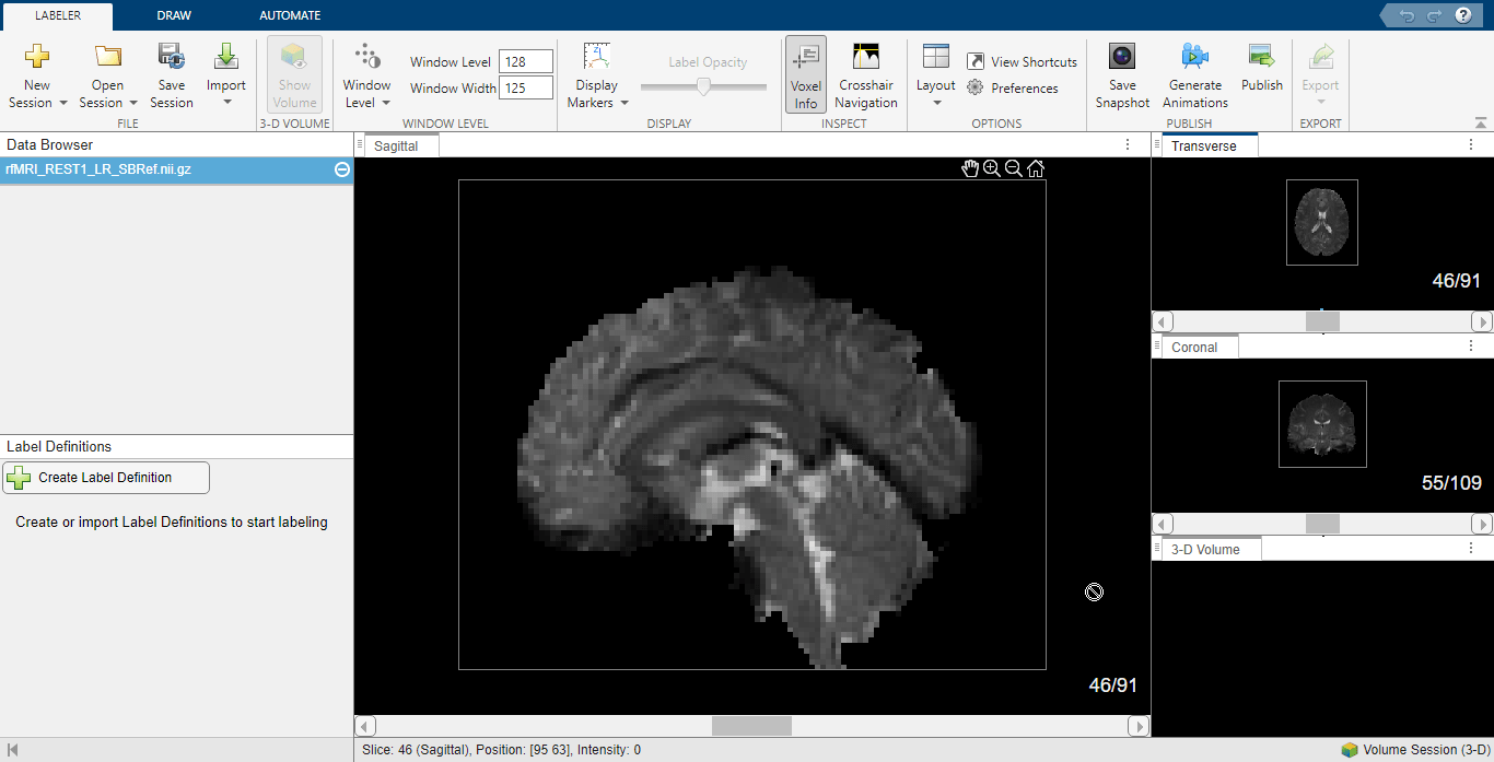 Compute Functional Connectivity from Brain fMRI - MATLAB & Simulink