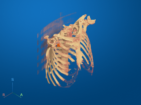Display Labeled Medical Image Volume In Patient Coordinate System Matlab And Simulink