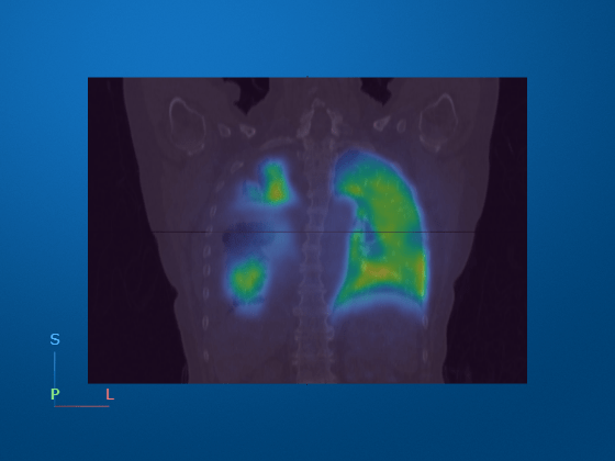 Display Multimodal Medical Image Data from PET and CT - MATLAB & Simulink