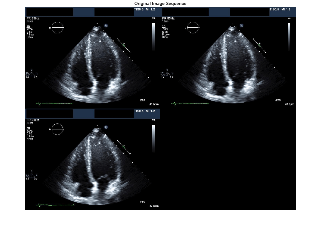 specklefilt - Filter image using speckle-reducing anisotropic diffusion ...
