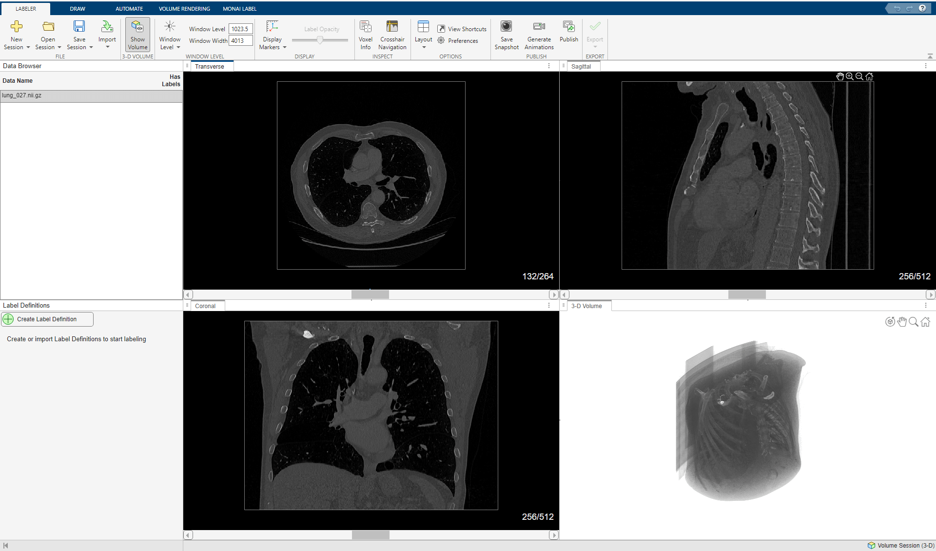Get Started with MedSAM in Medical Image Labeler - MATLAB & Simulink