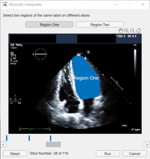 Label 2-D Ultrasound Series Using Medical Image Labeler - MATLAB & Simulink