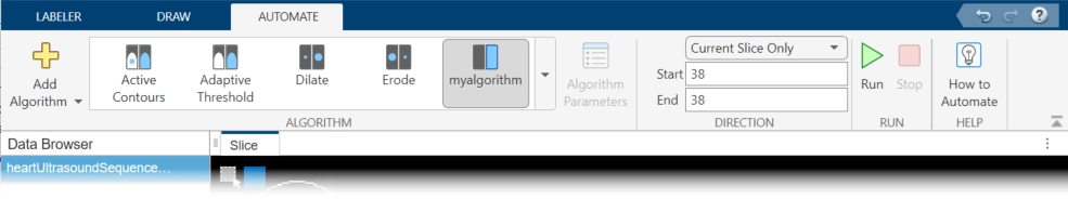 Label 2-D Ultrasound Series Using Medical Image Labeler - MATLAB & Simulink