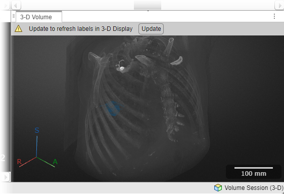 Get Started with Medical Imaging Toolbox