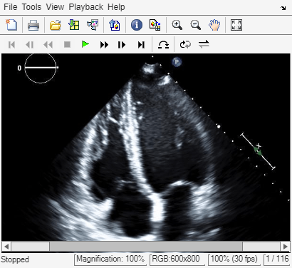 Read Process And View Ultrasound Data Matlab And Simulink