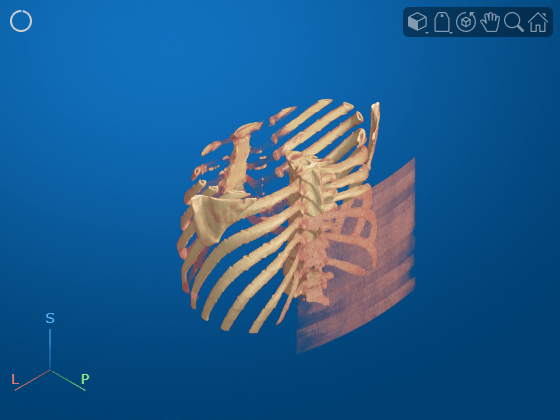 Read, Process, and Write 3-D Medical Images - MATLAB & Simulink