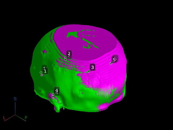 Register 3-D Multimodal Medical Image Volumes Using Anatomical ...