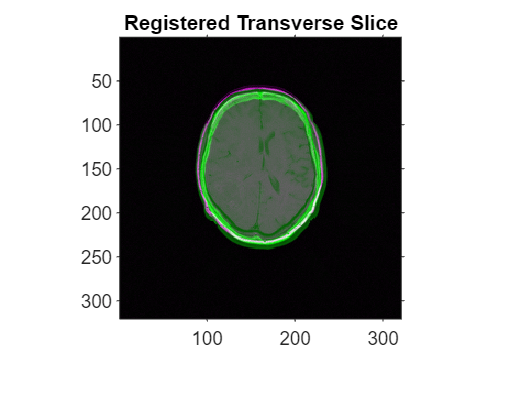 Register Multimodal Medical Image Volumes with Spatial Referencing ...