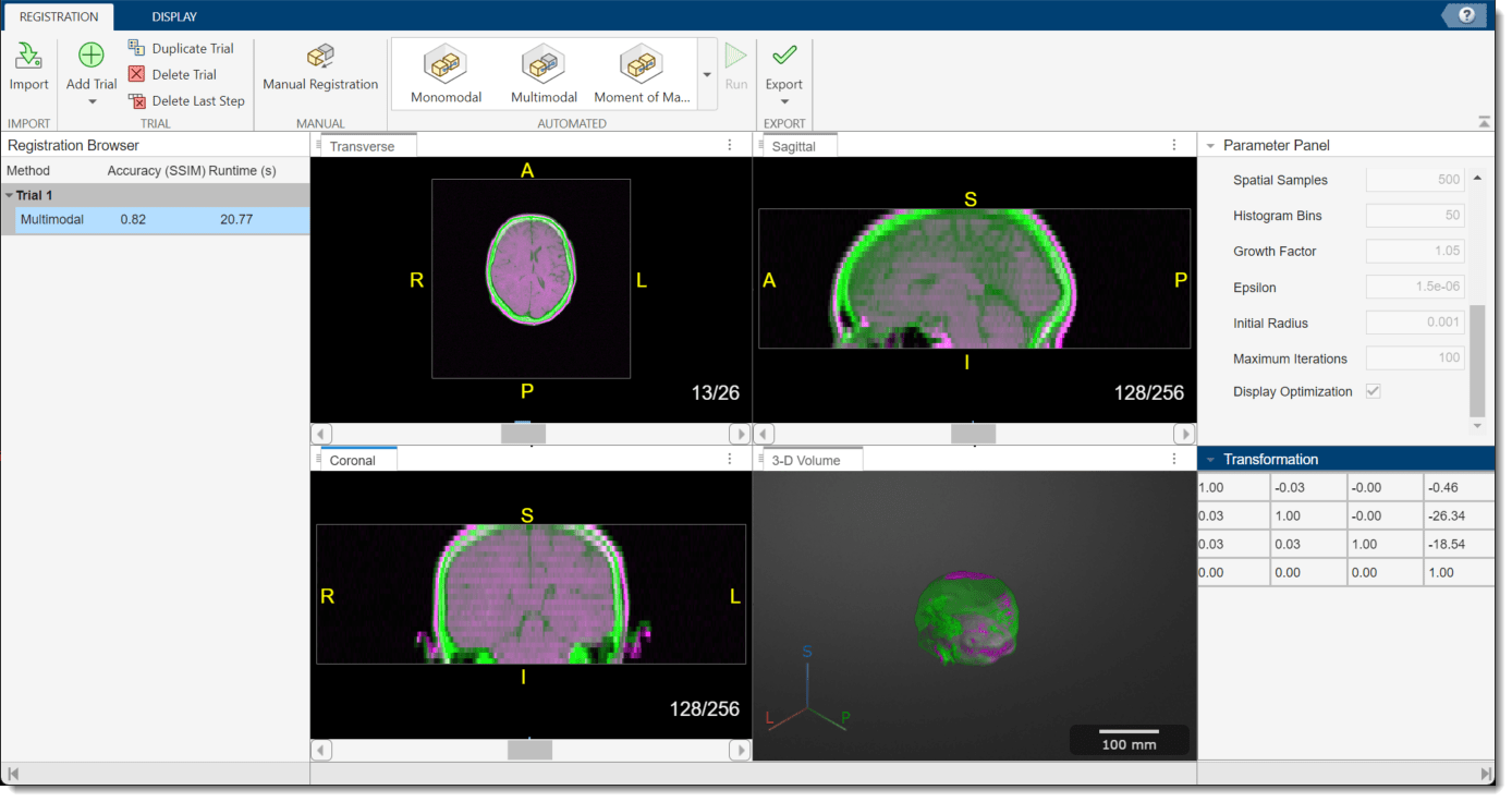 Rigid Registration Using Medical Registration Estimator App Matlab And Simulink