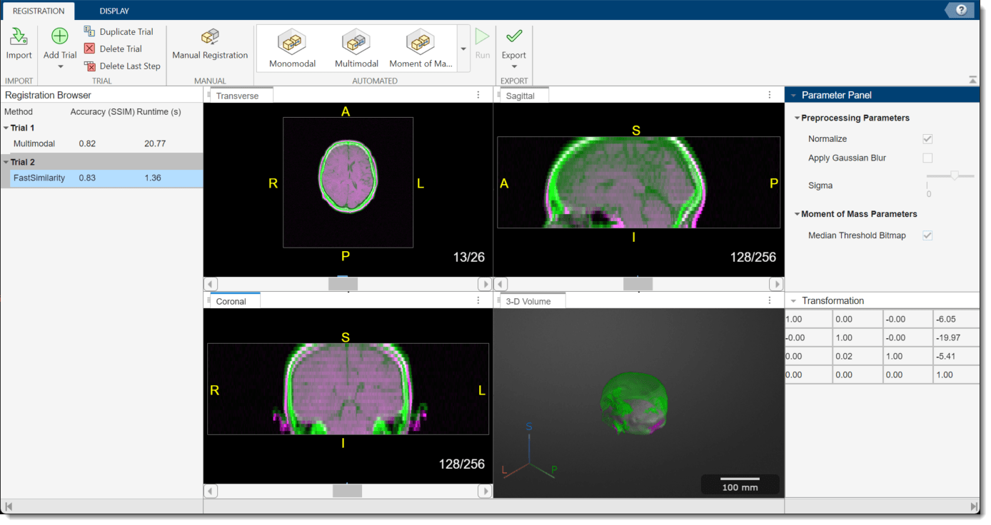 Rigid Registration Using Medical Registration Estimator App Matlab And Simulink