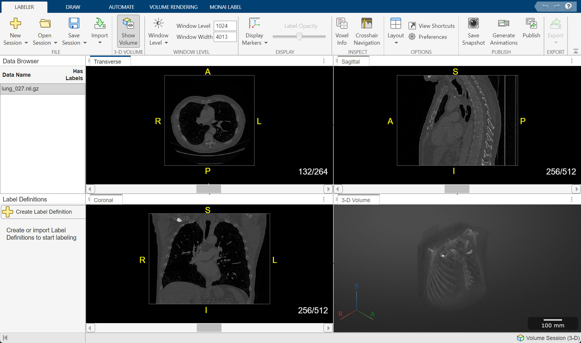 Visualize 3-D Medical Image Data Using Medical Image Labeler - MATLAB ...