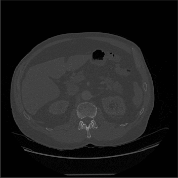Visualize 3-D Medical Image Data Using Medical Image Labeler - MATLAB ...