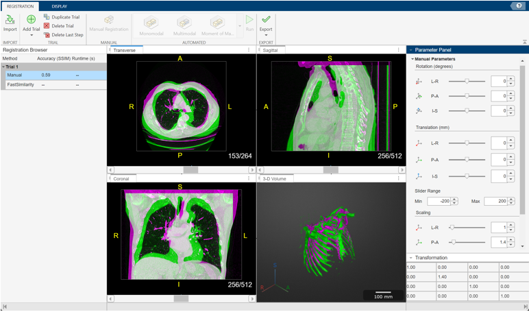Choose an Image Registration Technique - MATLAB & Simulink