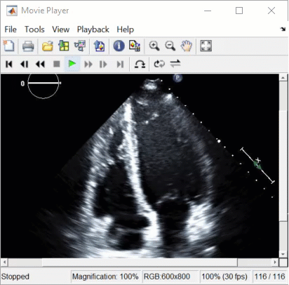 Choose Approach for Medical Image Visualization - MATLAB & Simulink